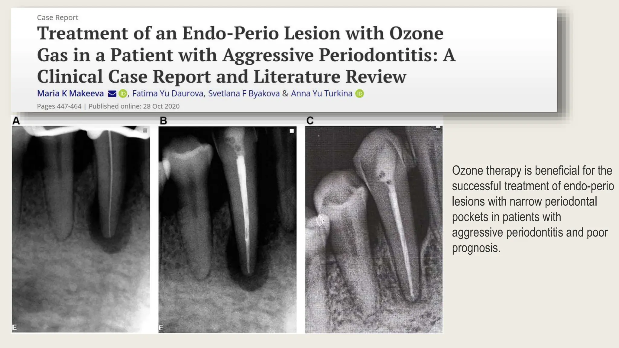 CLINICAL IMPLICATIONS OF ENDOPERIO LESIONS.pptx