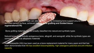 CLINICAL IMPLICATIONS OF ENDOPERIO LESIONS.pptx