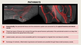 CLINICAL IMPLICATIONS OF ENDOPERIO LESIONS.pptx