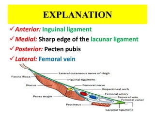 CLINICAL IMPORTANCE OF FEMORAL CANAL.pptx