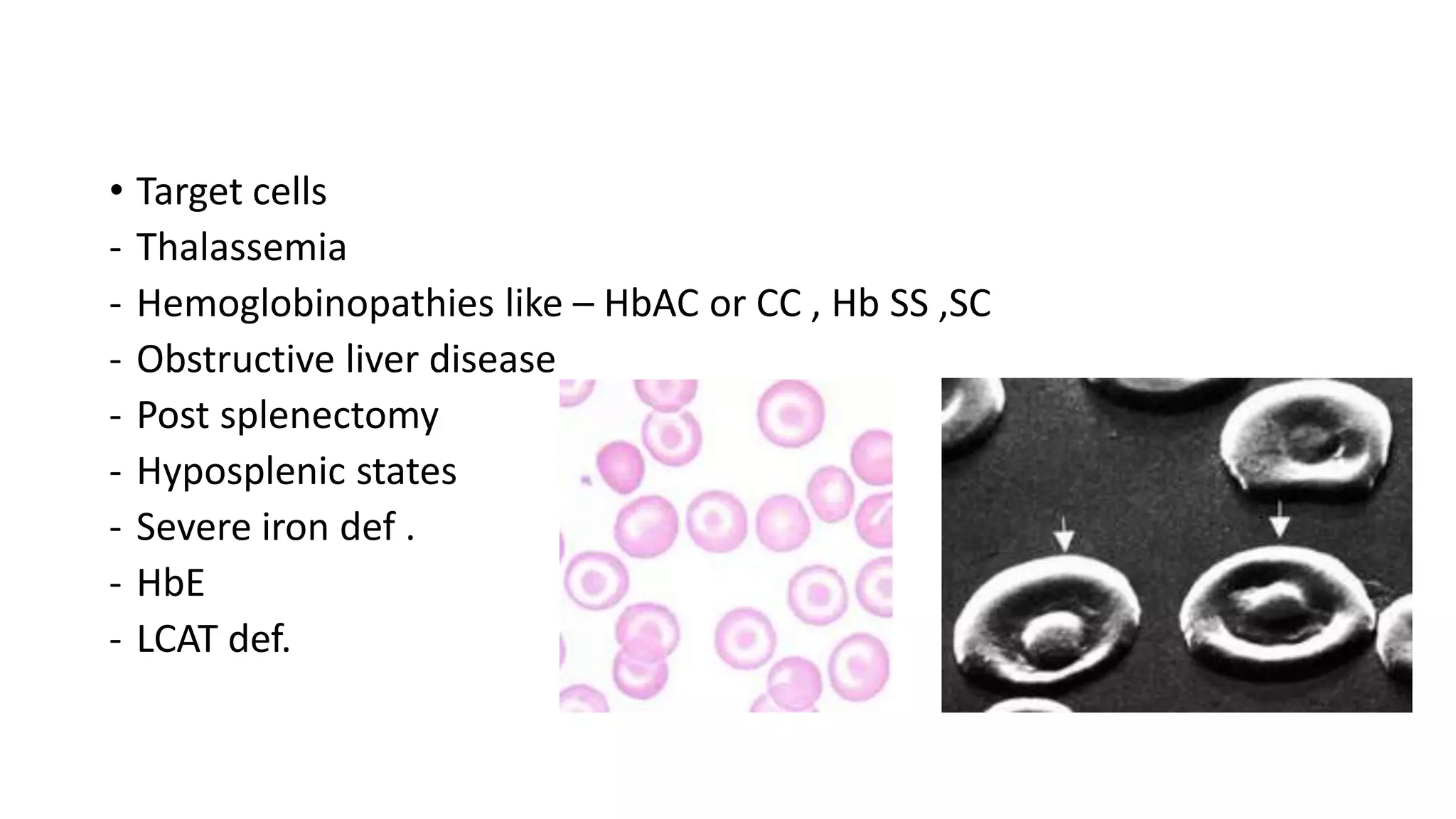 Clinical interpretation of cbc | PPTX