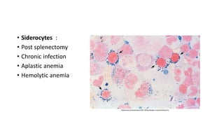 Clinical interpretation of cbc | PPTX