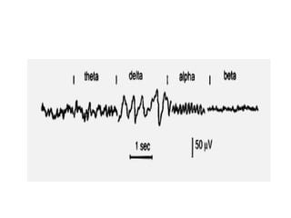 clinical interpretation of eeg and disease based interpretation .pptx