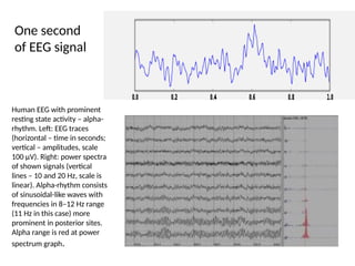 clinical interpretation of eeg and disease based interpretation .pptx