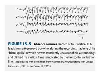 clinical interpretation of eeg and disease based interpretation .pptx