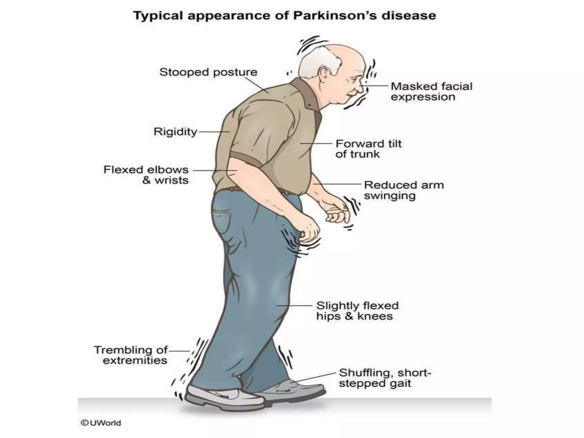 Clinical Pharmacy - Drug Profile of Levodopa | PPTX