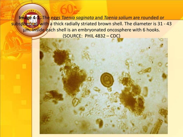 Cestodes | PPTX | Infectious Diseases | Diseases and Conditions