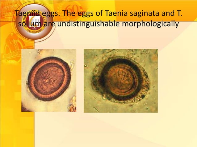 Cestodes | PPTX | Infectious Diseases | Diseases and Conditions