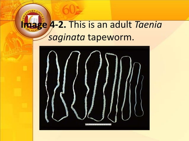 Cestodes | PPTX | Infectious Diseases | Diseases and Conditions