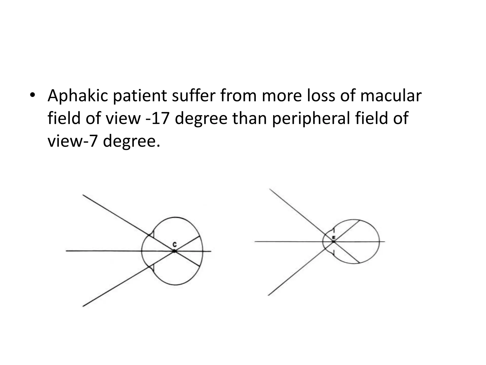 Clinical Management of Aphakia and Pseudophakia.pptx