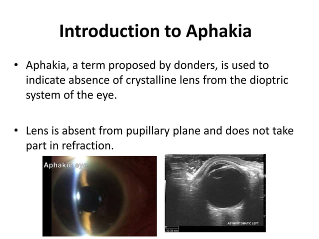Clinical Management of Aphakia and Pseudophakia.pptx | Eye and Vision ...