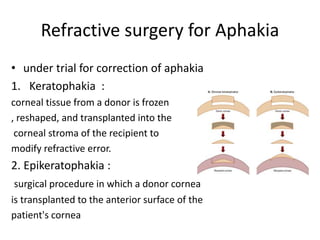 Clinical Management of Aphakia and Pseudophakia.pptx