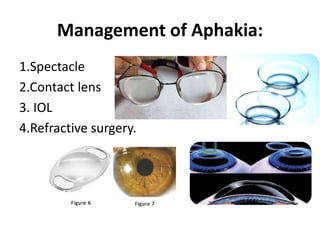Clinical Management of Aphakia and Pseudophakia.pptx