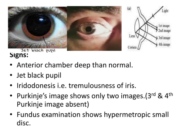 Clinical Management of Aphakia and Pseudophakia.pptx