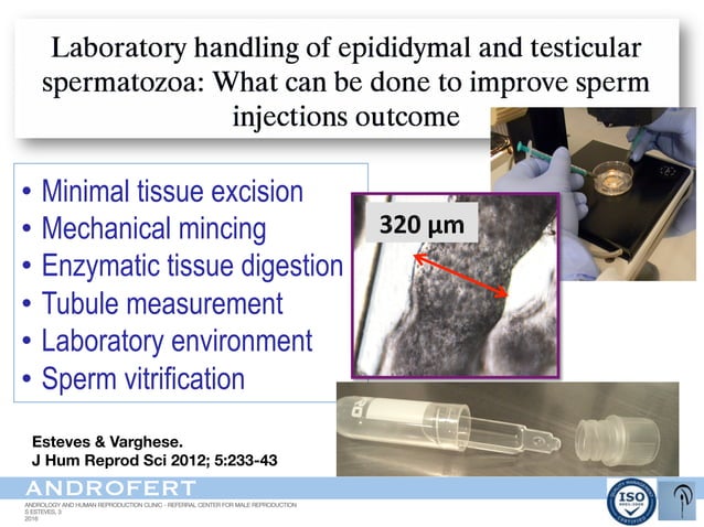 Clinical management of men with nonobstructive azoospermia - Role of ...