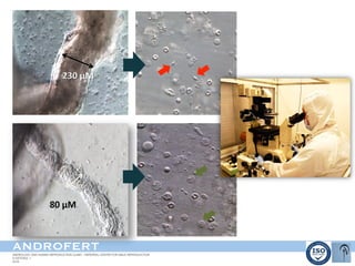 Clinical management of men with nonobstructive azoospermia - Role of ...