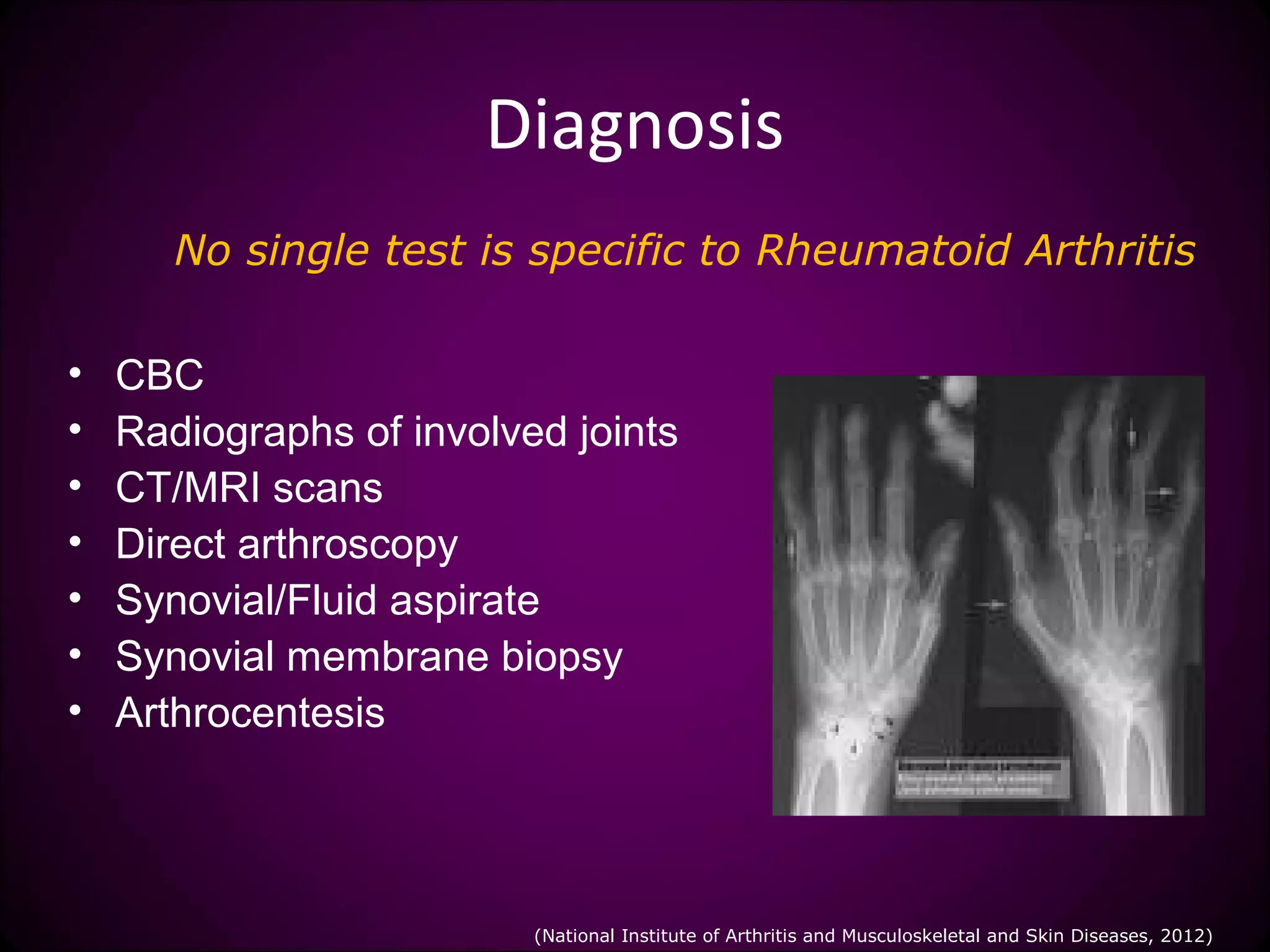 Clinical management of rheumatoid arthritis in peptic and duodenal ...