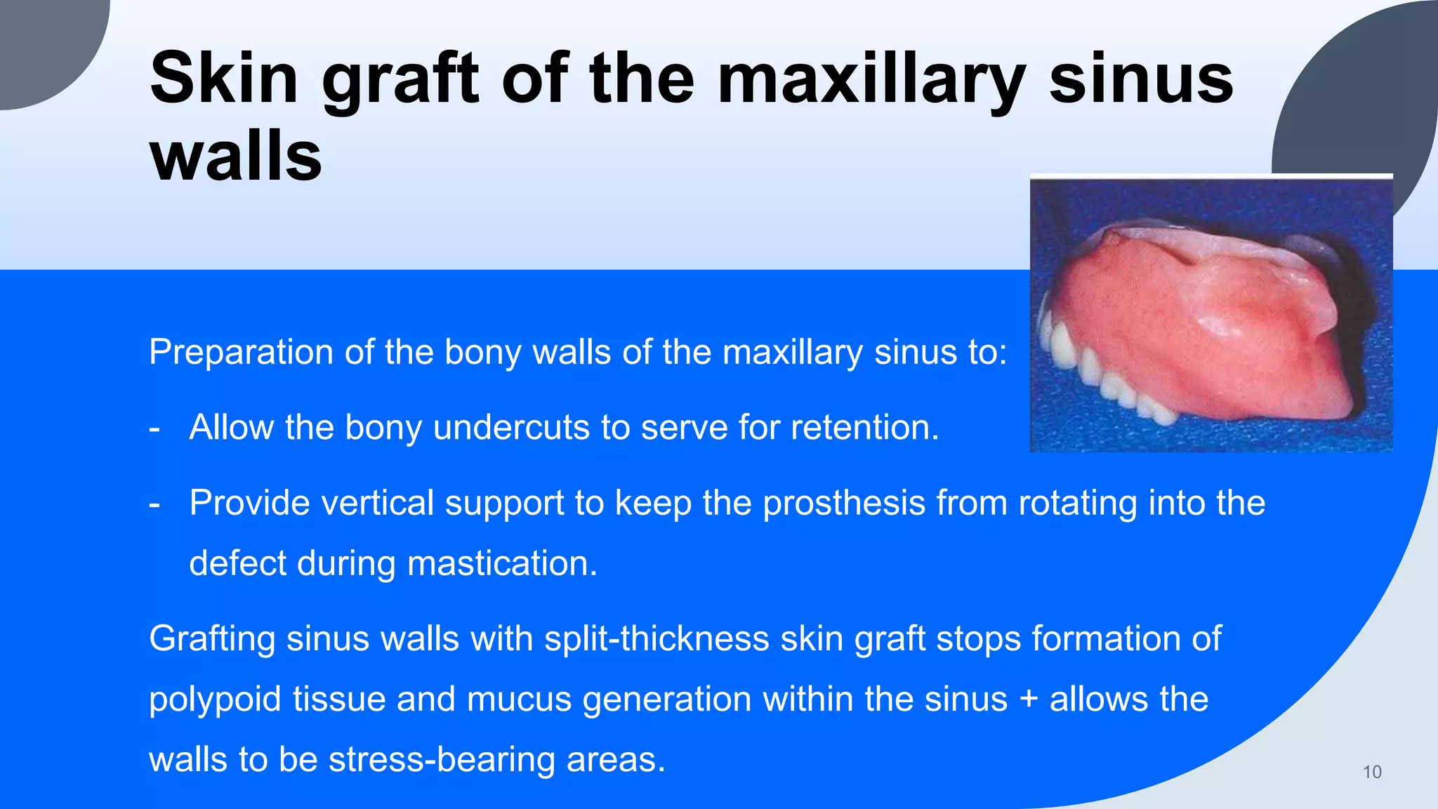 Clinical management of the edentulous maxillectomy patient.pptx