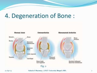 clinical manifestation and diagnostic consideration in arthritis.pptx