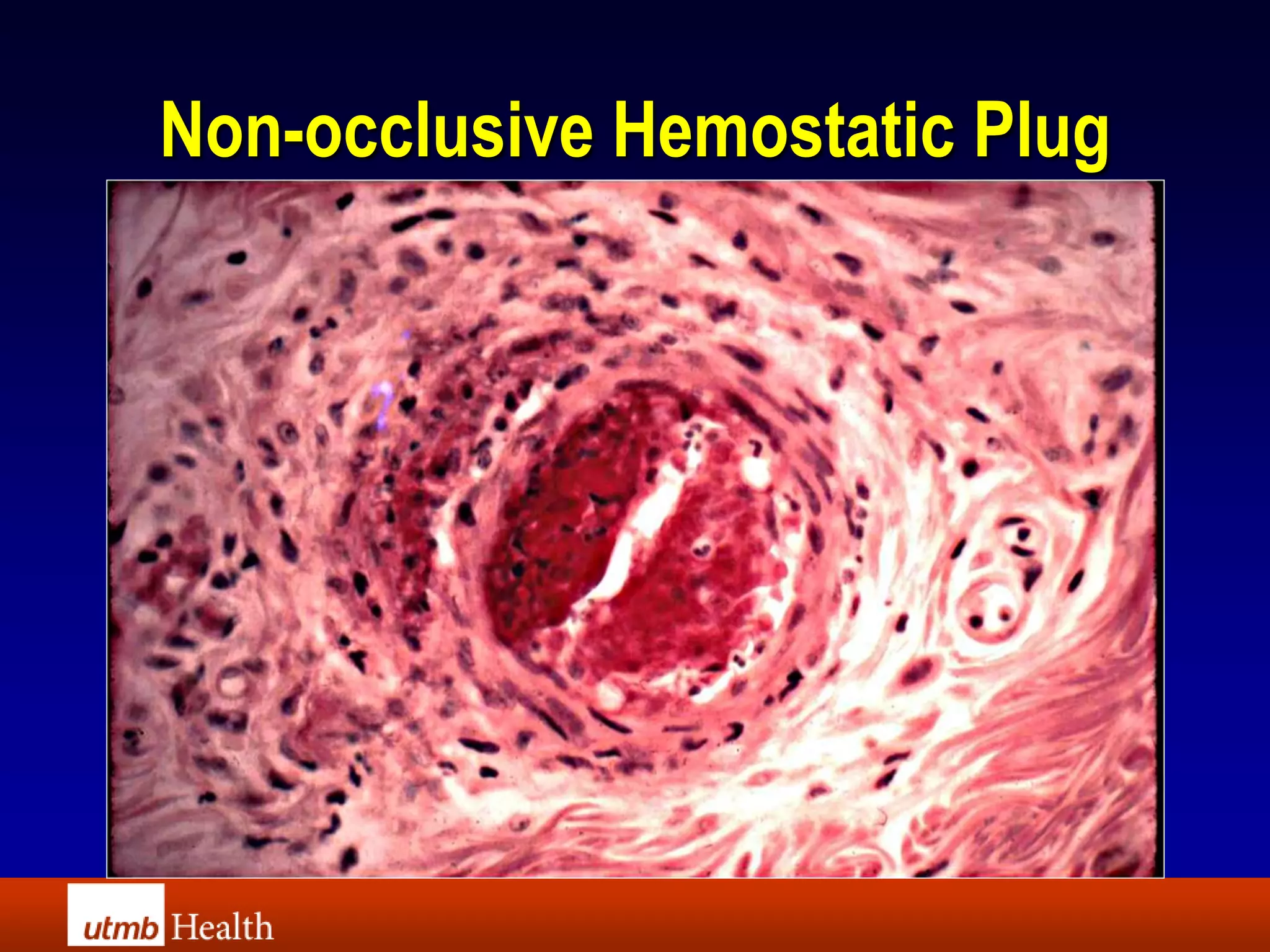 Clinical Manifestation and Pathogenesis of Obligately Intracellular ...