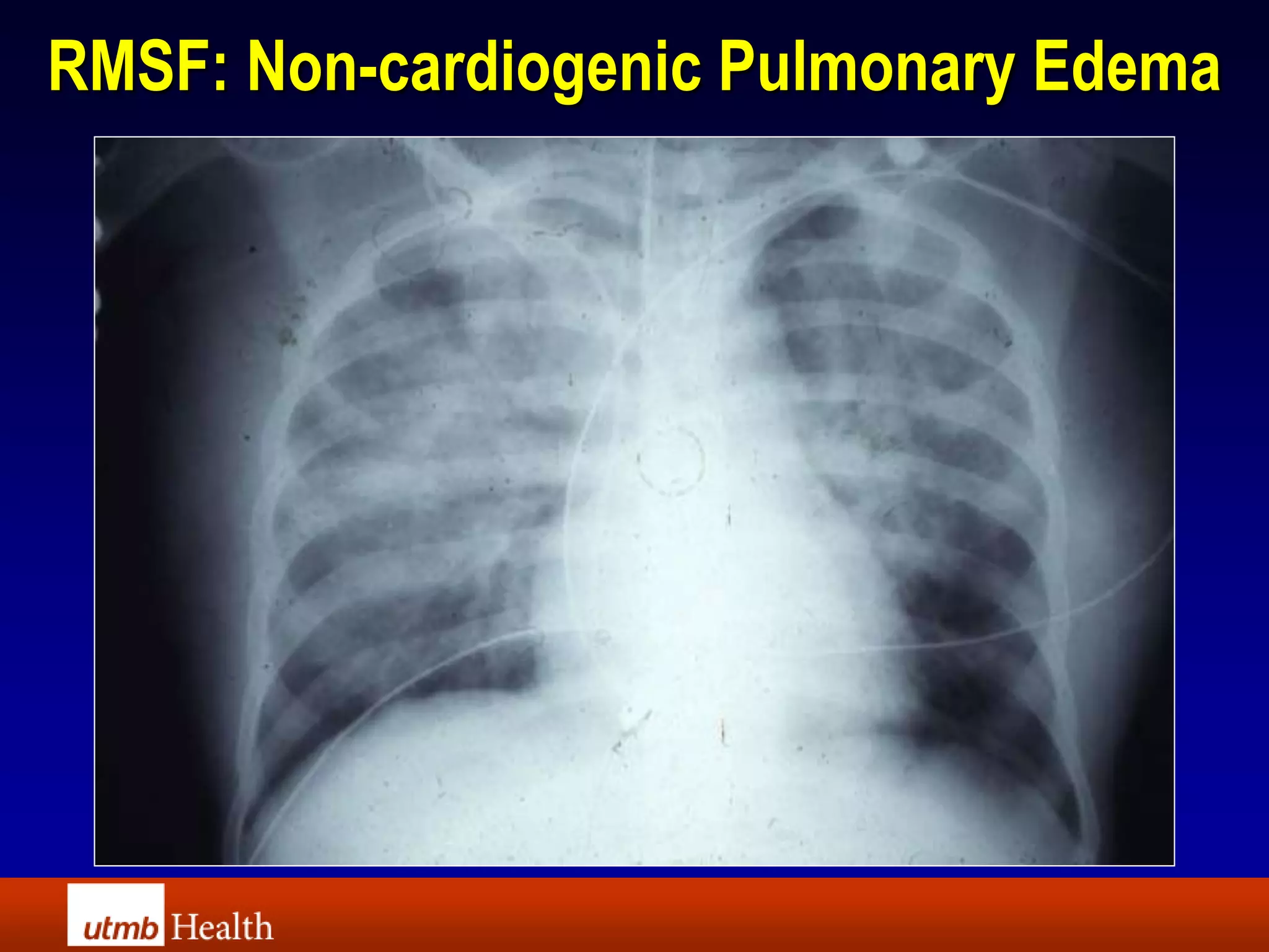 Clinical Manifestation and Pathogenesis of Obligately Intracellular ...