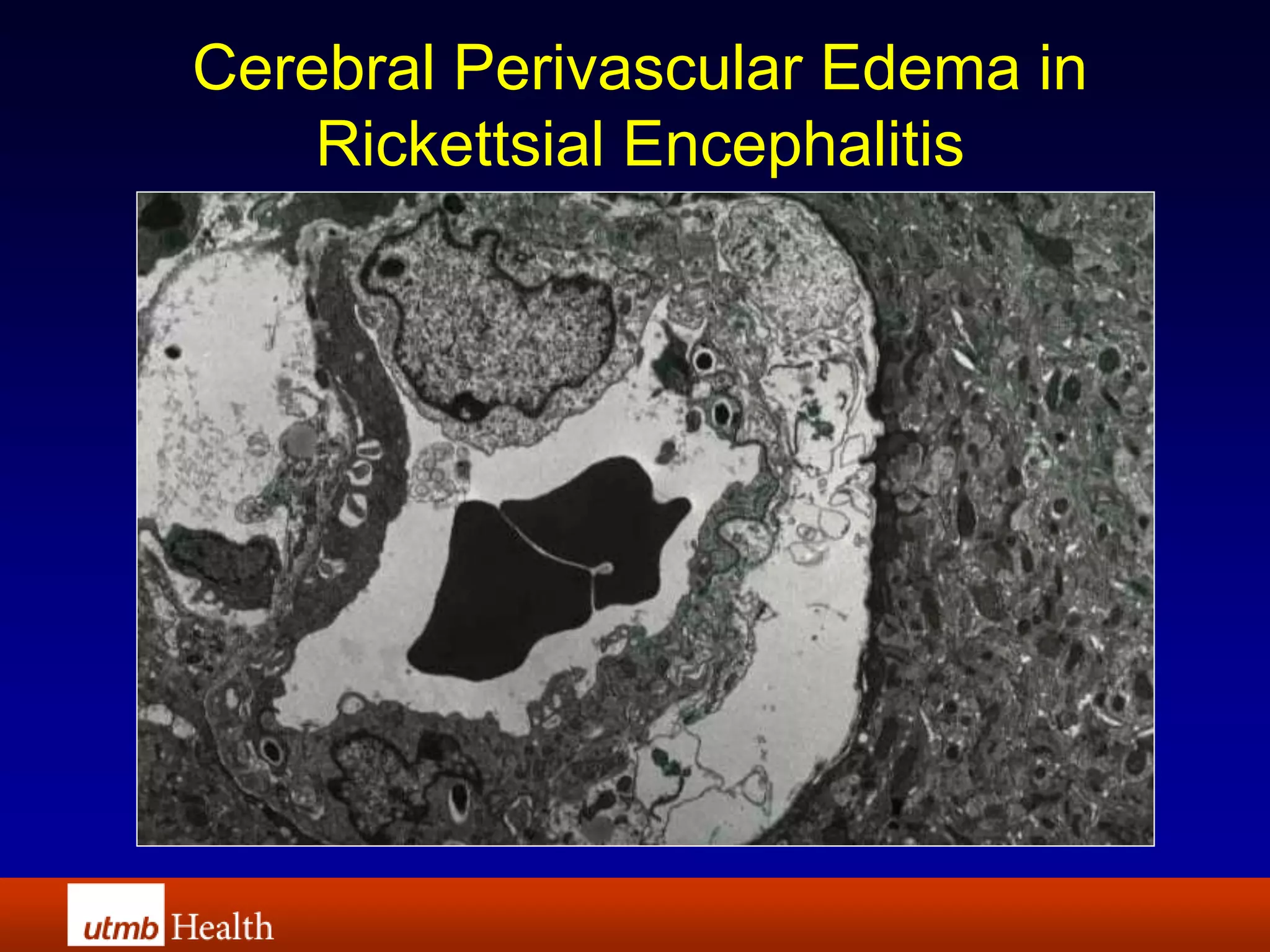 Clinical Manifestation and Pathogenesis of Obligately Intracellular ...