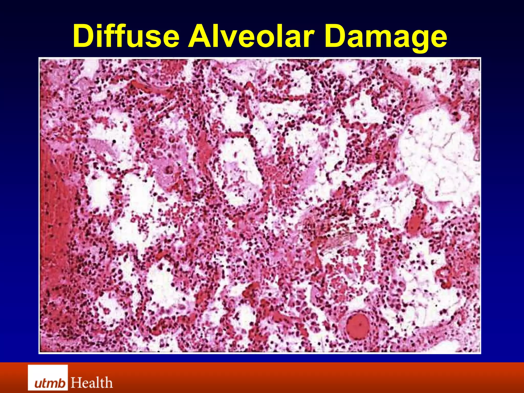 Clinical Manifestation and Pathogenesis of Obligately Intracellular ...