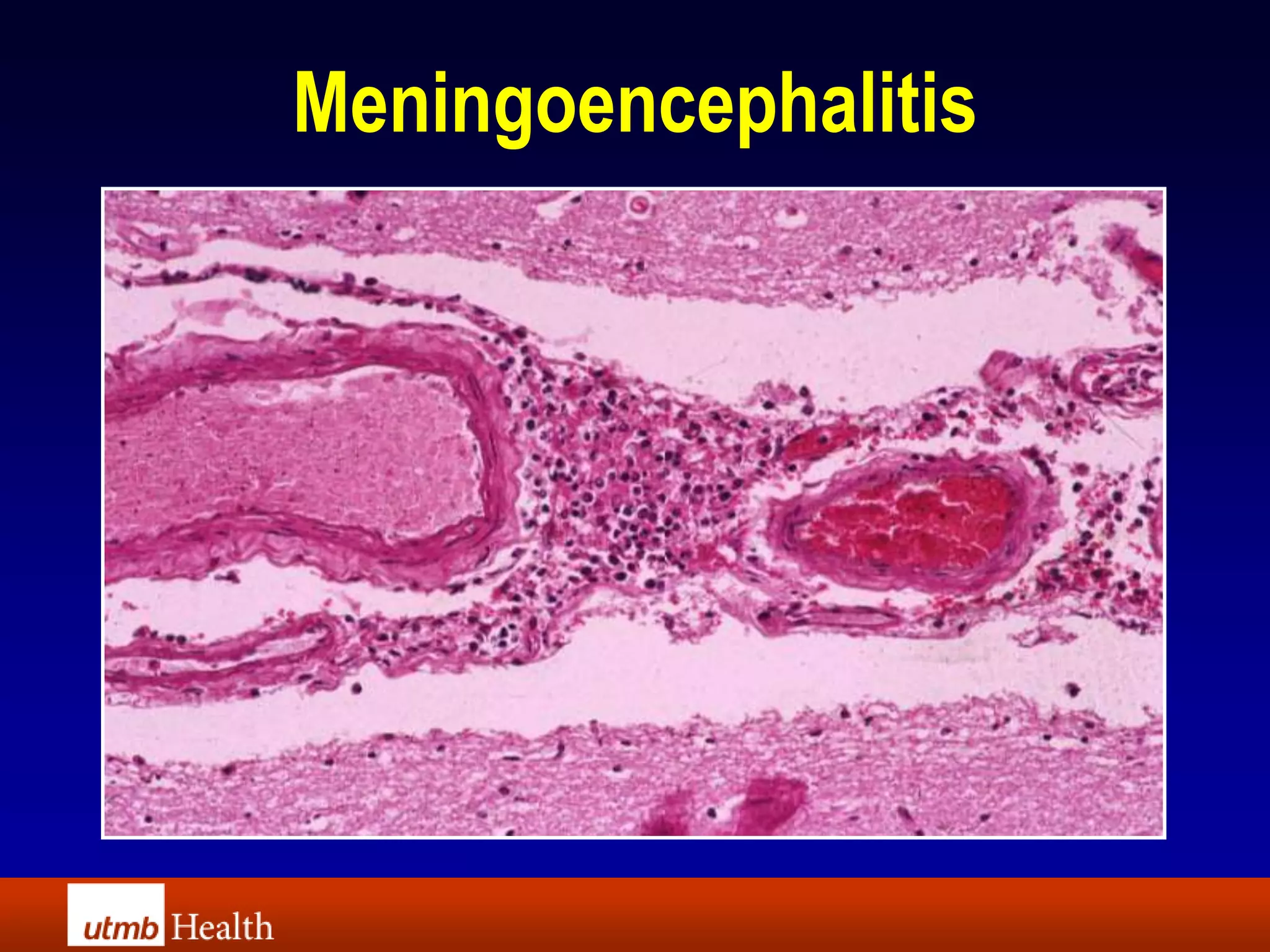 Clinical Manifestation and Pathogenesis of Obligately Intracellular ...
