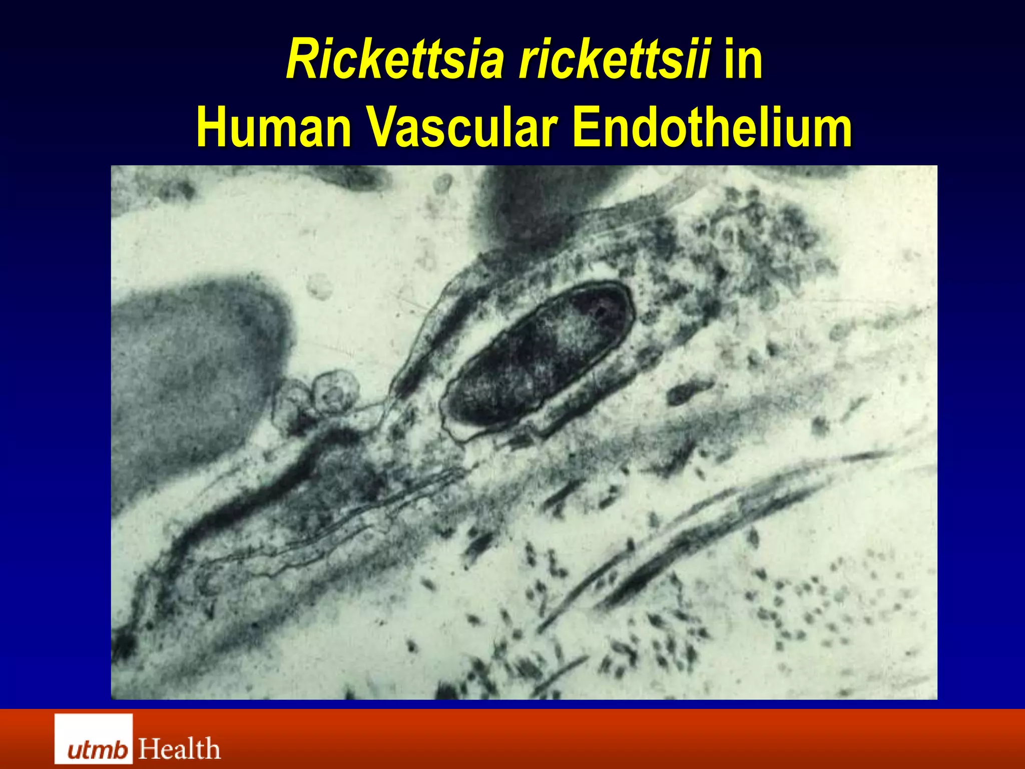 Clinical Manifestation and Pathogenesis of Obligately Intracellular ...