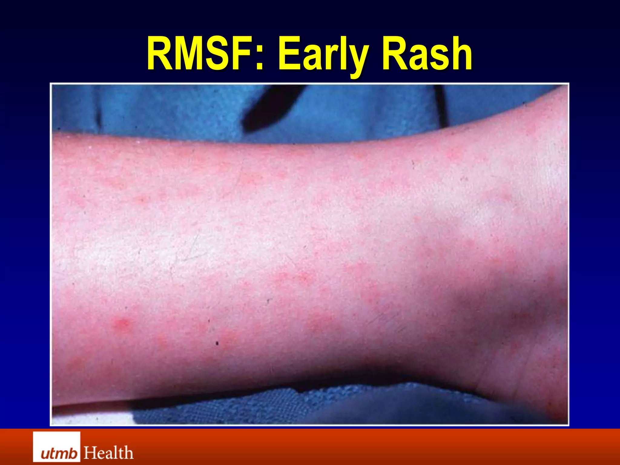 Clinical Manifestation and Pathogenesis of Obligately Intracellular ...