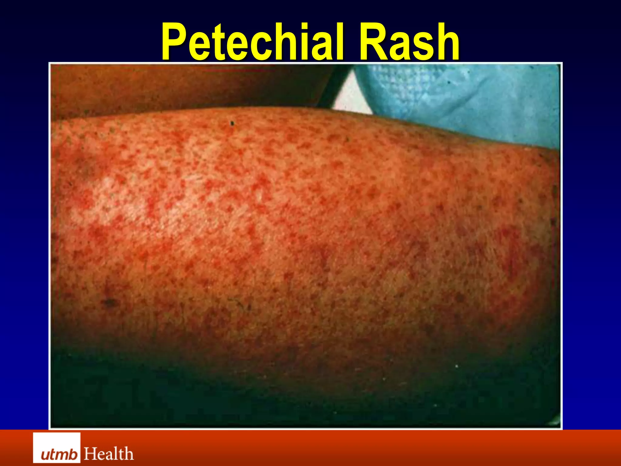 Clinical Manifestation and Pathogenesis of Obligately Intracellular ...