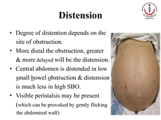 Clinical Manifestations of Intestinal Obstruction (Constipation) | PPTX
