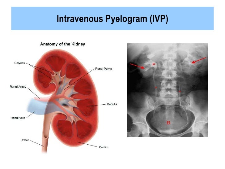 Clinical manifestations of_renal_diseasesffff - copy (2)