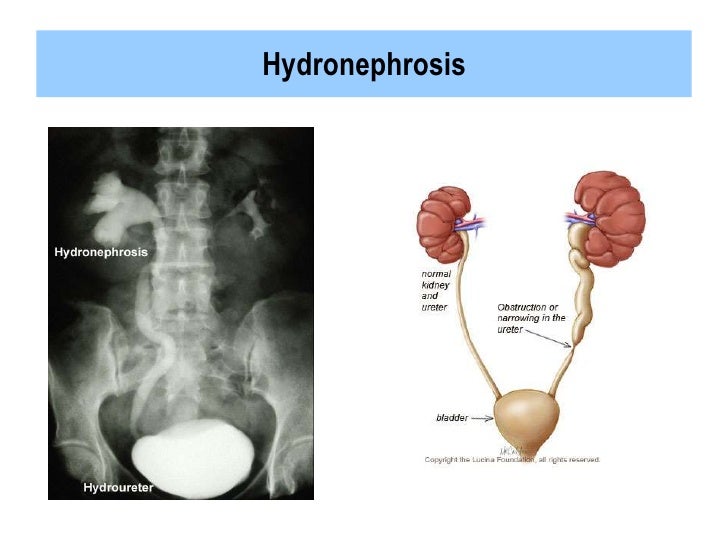 Clinical manifestations of_renal_diseasesffff - copy (2)