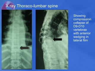Clinical meet | PPT | Blood Disorders | Diseases and Conditions