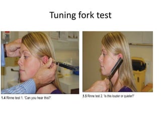 Clinical methods - ENT.pptx