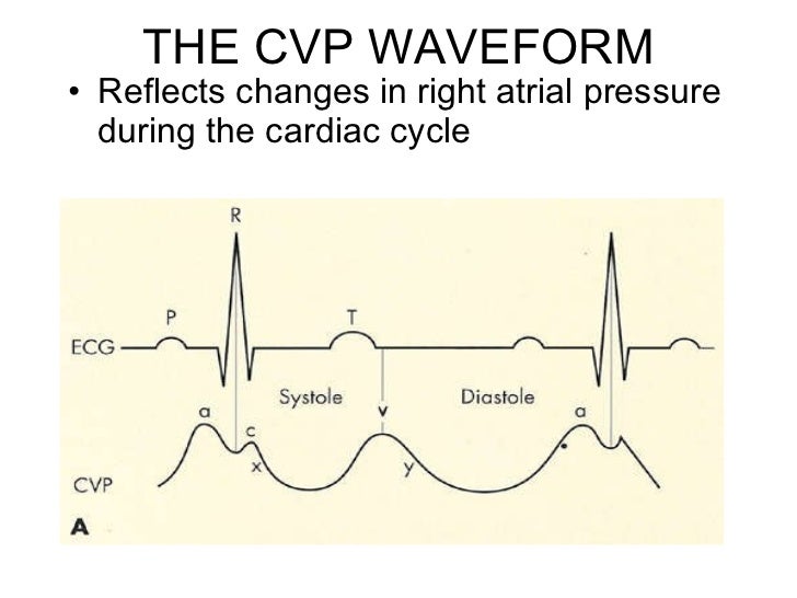 Clinical monitoring in ICU