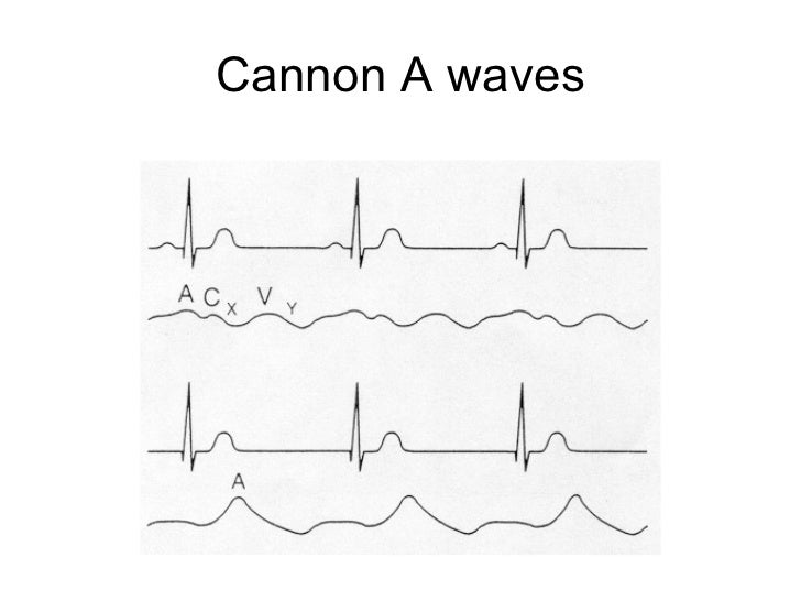 Clinical monitoring in ICU
