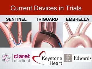 Clinical needs finding presentation tavi | PPT