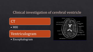 clinical Neuroanatomy_of_ventricular_system_ and CSF suparna[1]-1.pptx