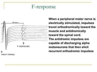END-Techniques | PPT