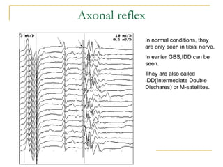 END-Techniques | PPT