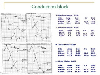 END-Techniques | PPT