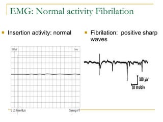 END-Techniques | PPT