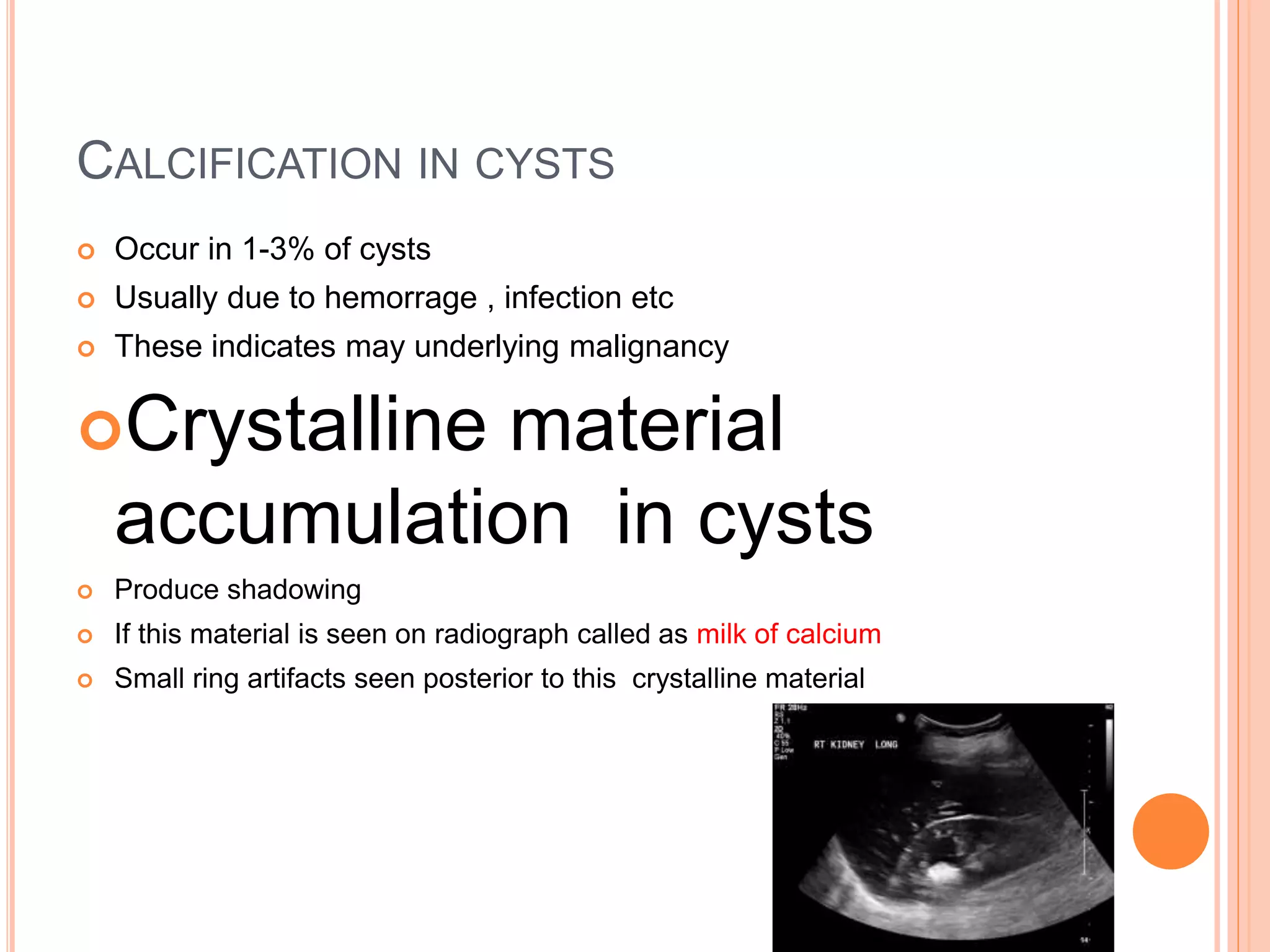 anatomy and sonography of kidney | PPTX