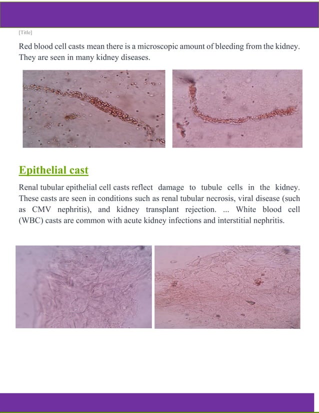 Clinical pathology Notes | PDF | Blood Disorders | Diseases and Conditions
