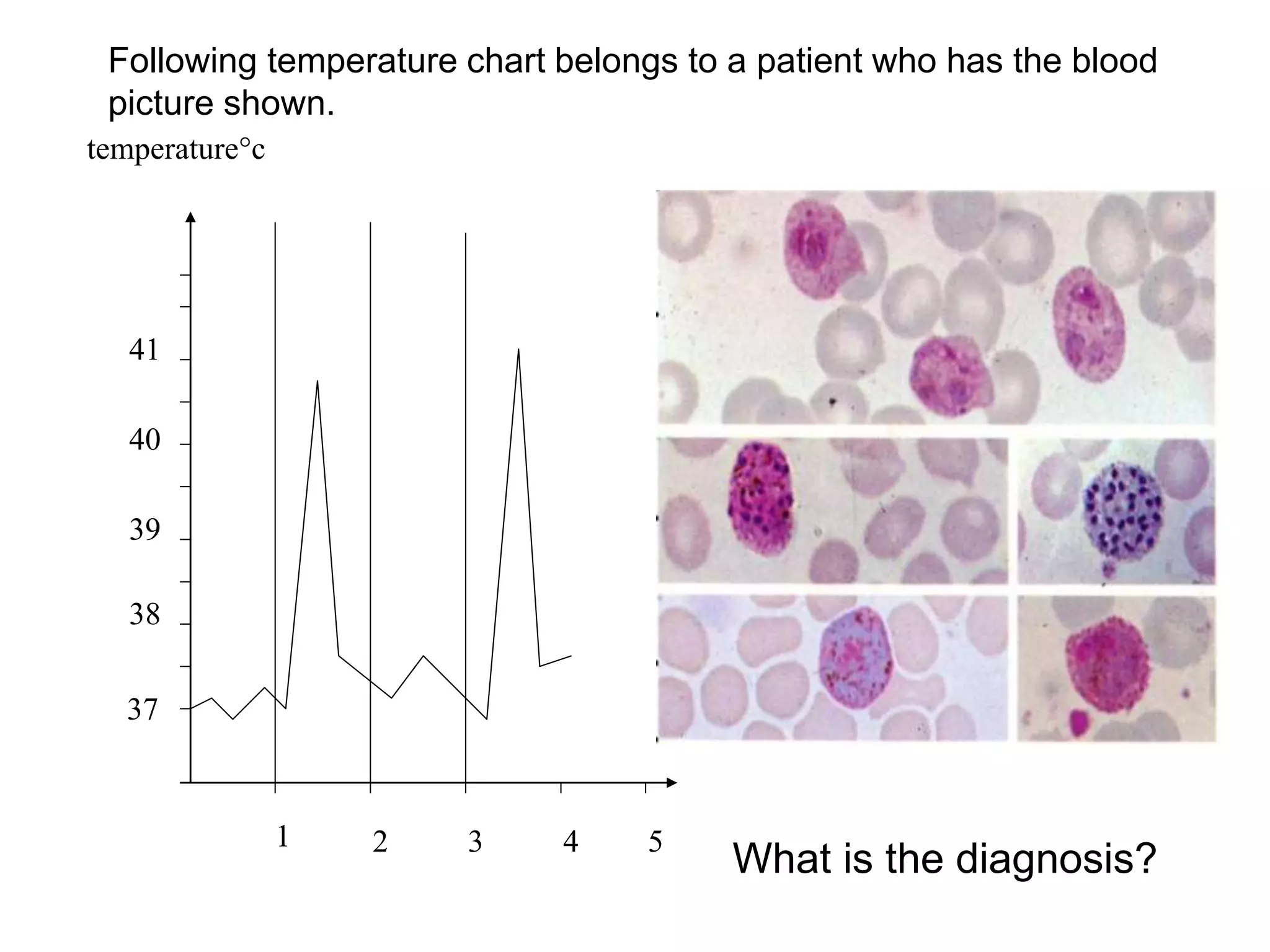 Clinical pathology spots for final MBBS | PDF