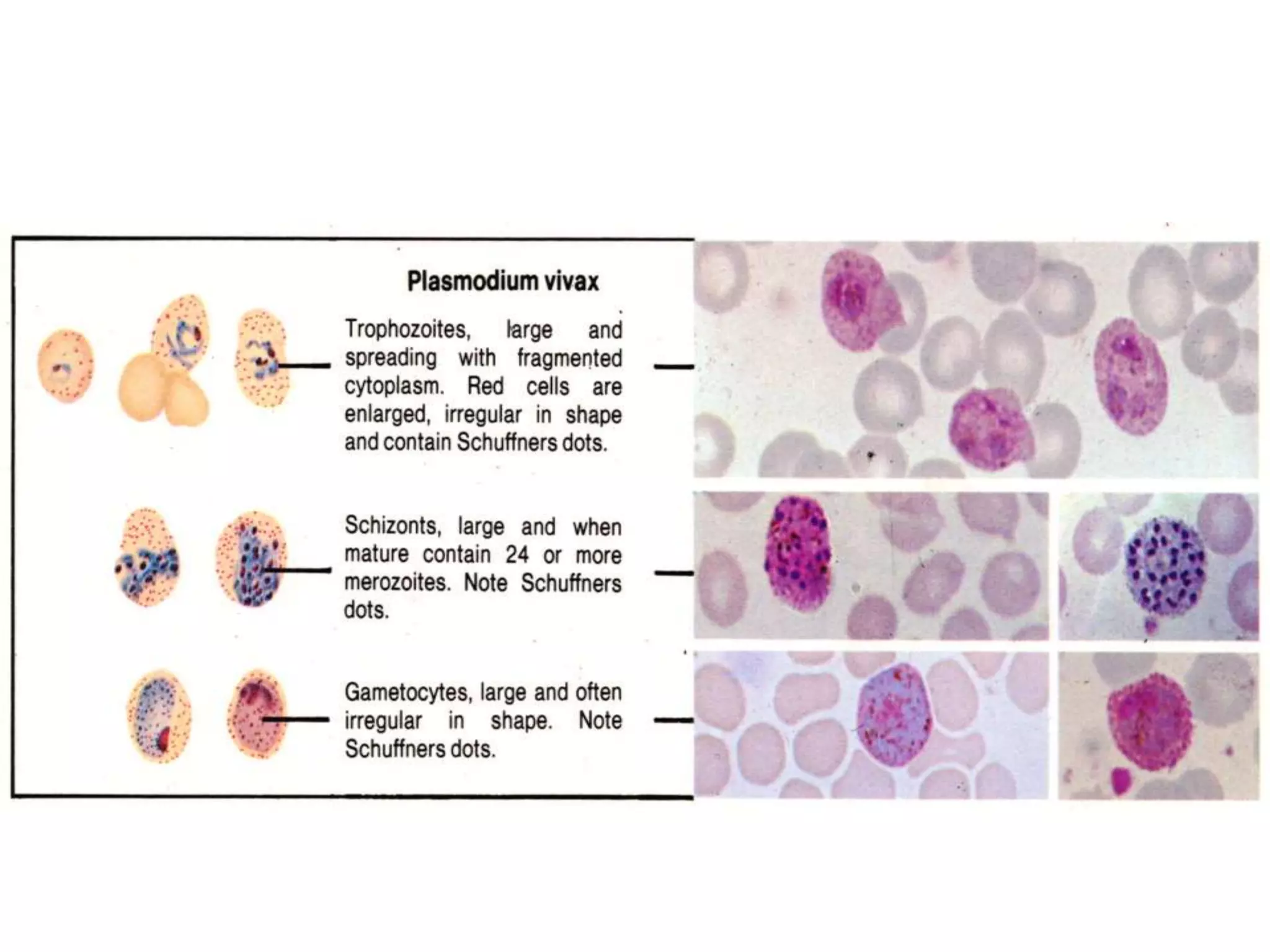 Clinical pathology spots for final MBBS | PDF