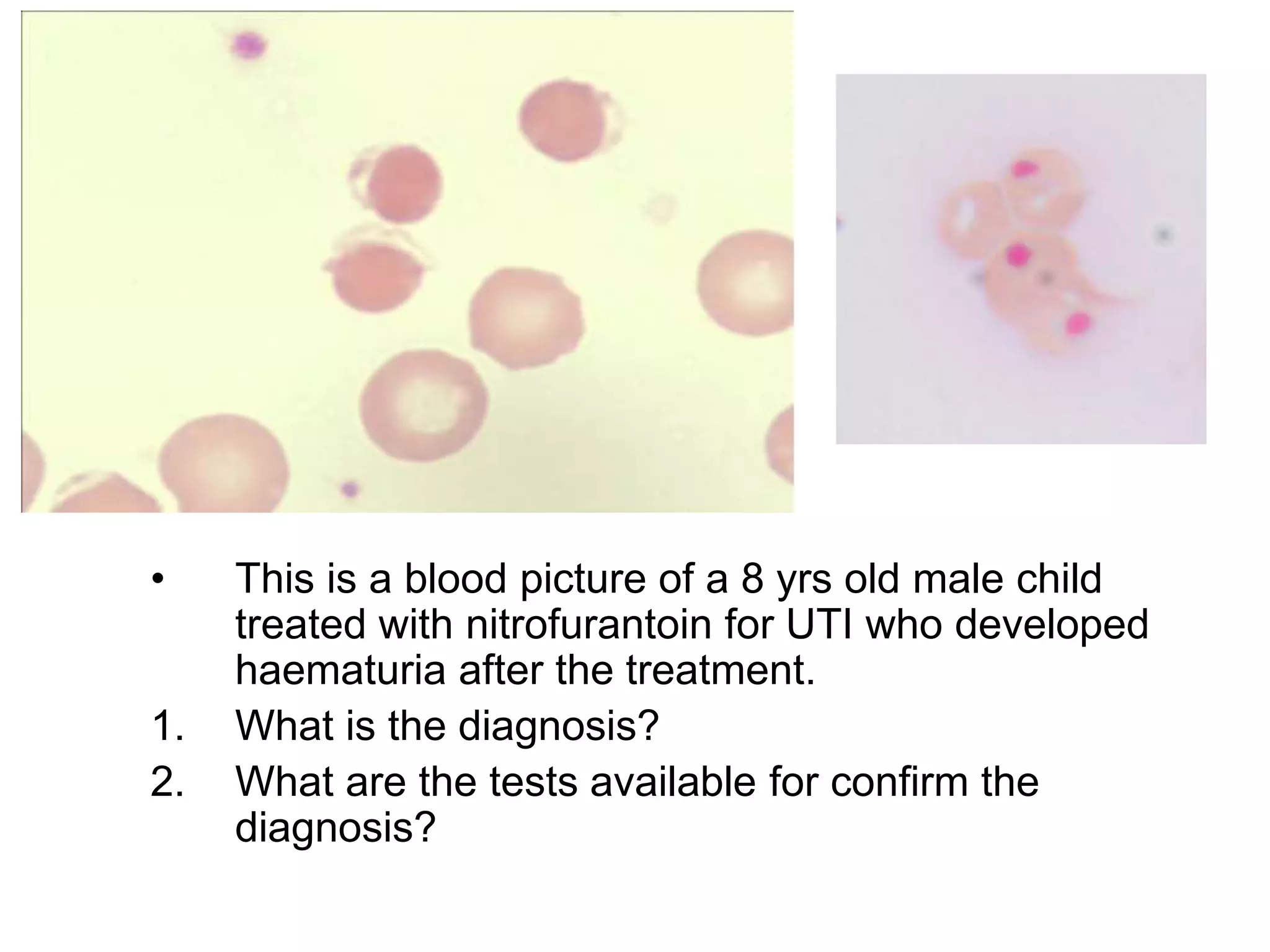 Clinical pathology spots for final MBBS | PDF