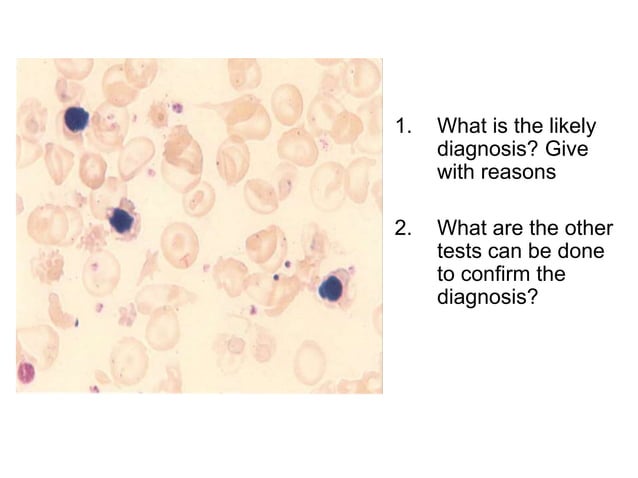 Clinical pathology spots for final MBBS | PDF